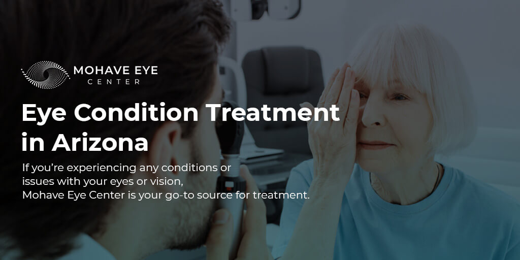 Eye Conditions We Treat | Mohave Eye Center